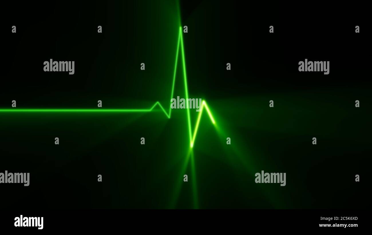 Ekg monitor hi-res stock photography and images - Alamy