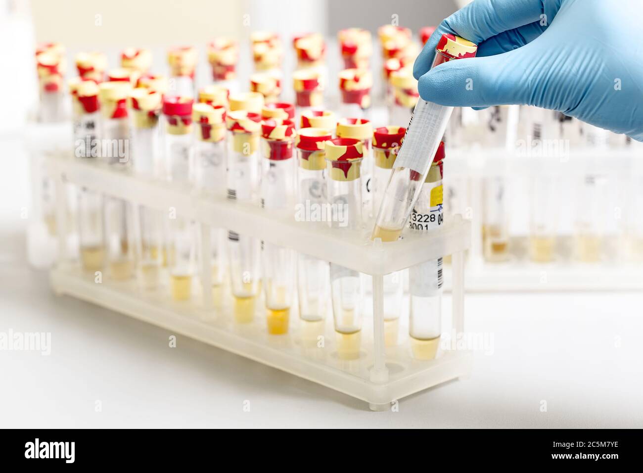 A chemical sample bottle. Centrifuge. A test tube vial sets for ...