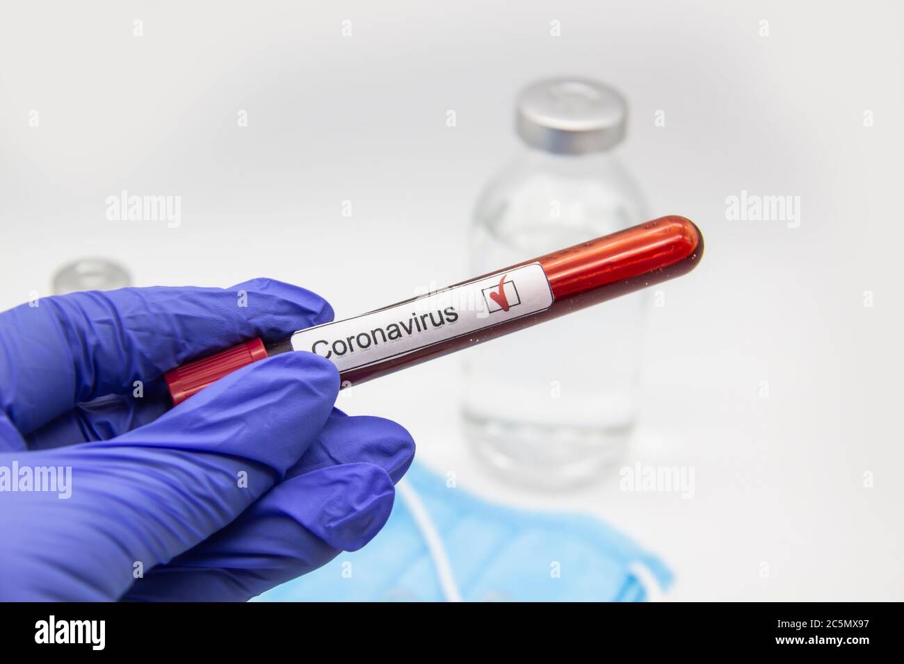 Coronavirus blood test 2019.Coronavirus came from Wuhan, China. Doctor ...
