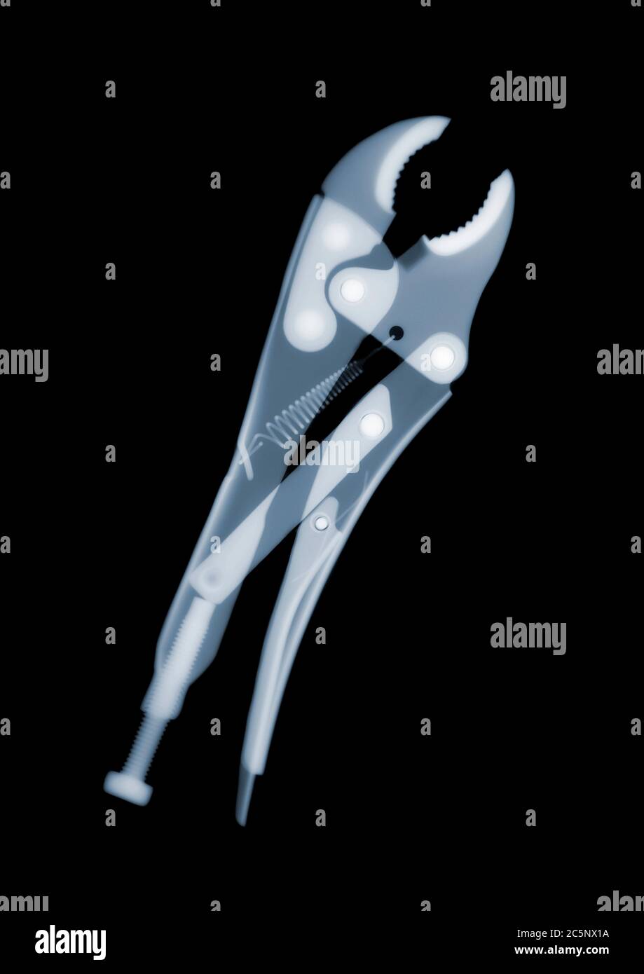 Mole grip, X-ray Stock Photo - Alamy