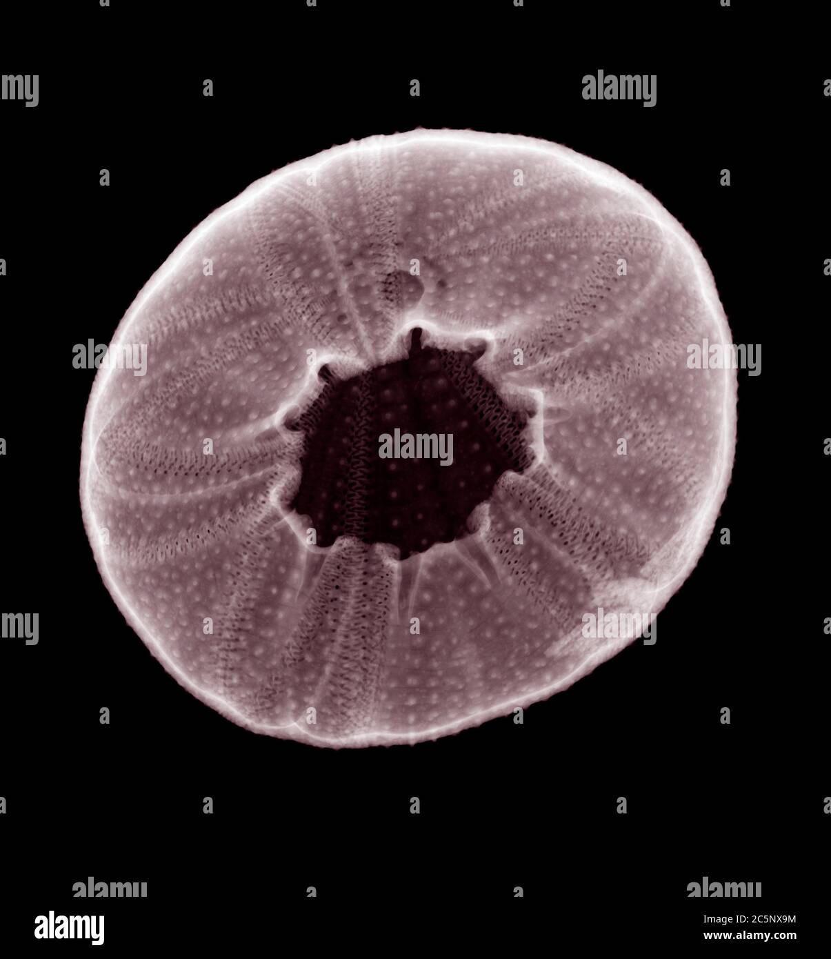 Sea urchin (Temnopleurus sp.), coloured X-ray Stock Photo - Alamy