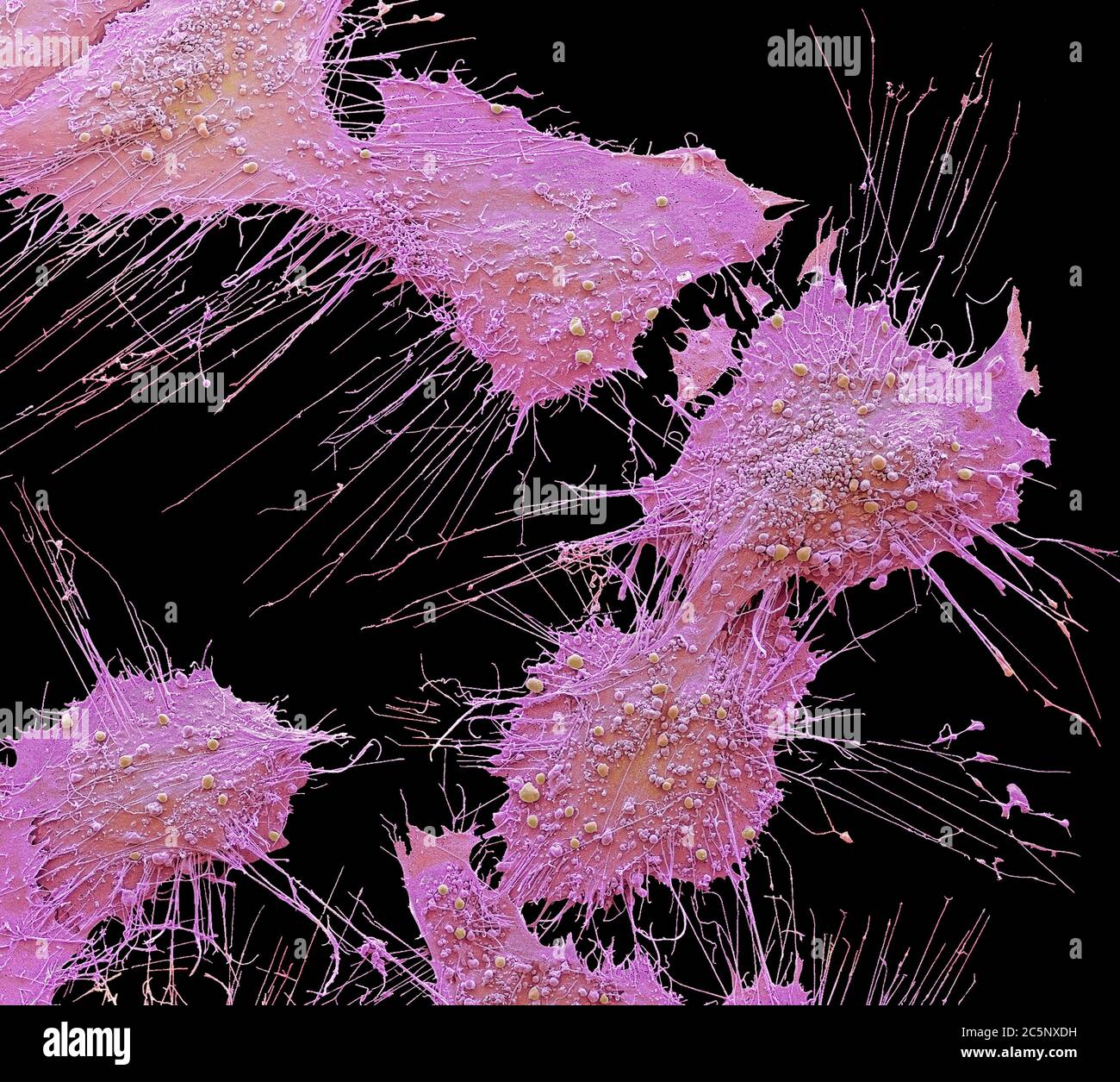 Cancer cells under microscope hi-res stock photography and images - Alamy