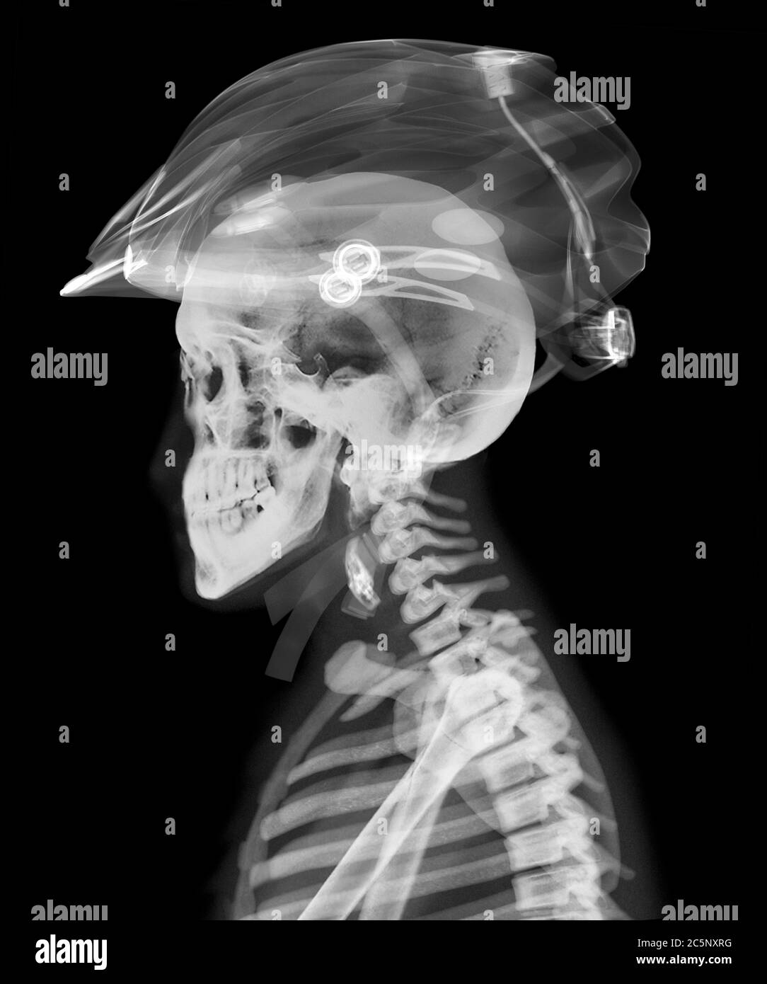 Sports helmet anatomy hi-res stock photography and images - Alamy