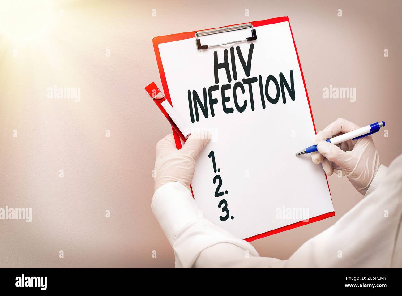 Word writing text Hiv Infection. Business photo showcasing A disease of ...