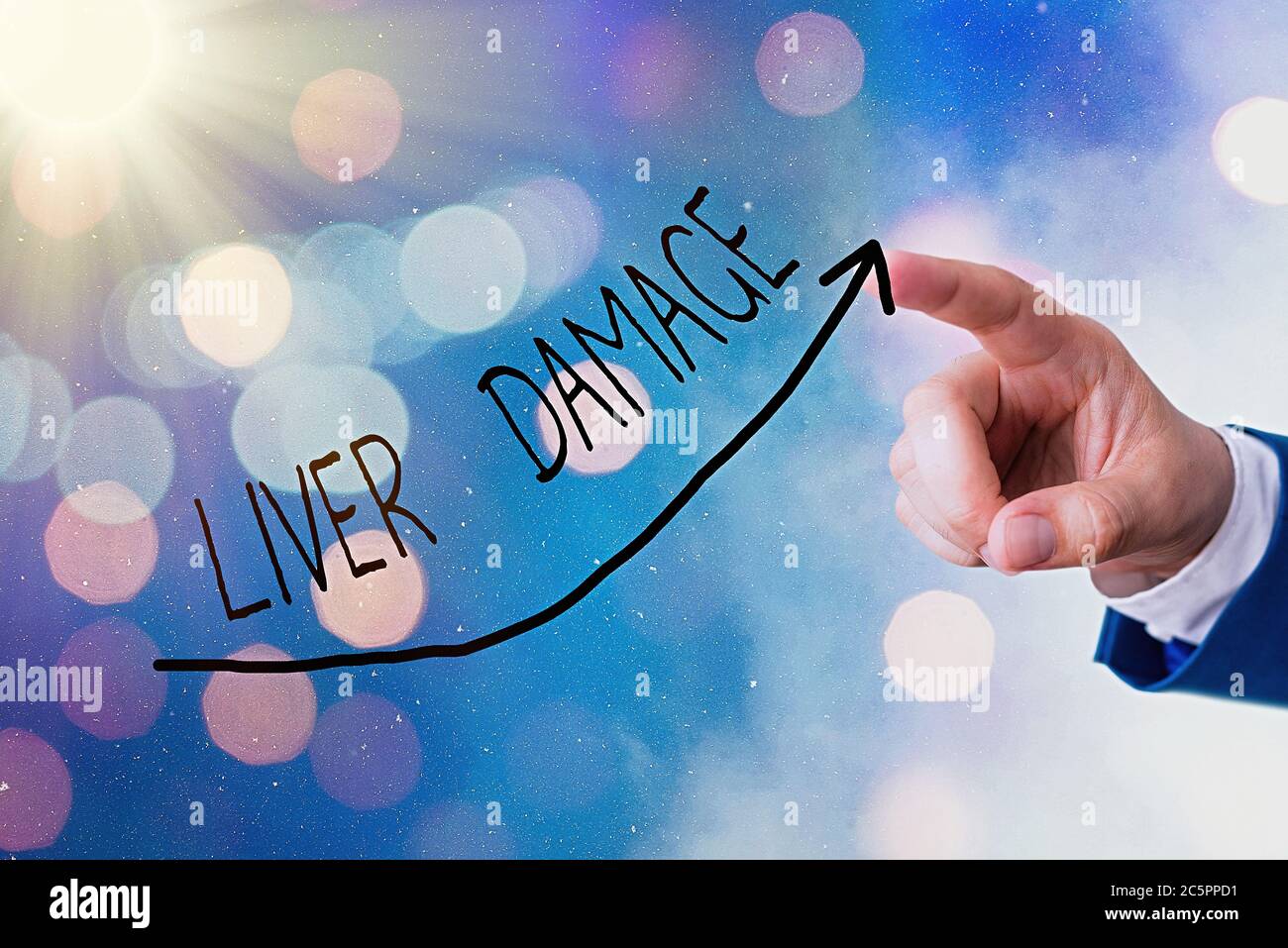Word writing text Liver Damage. Business photo showcasing any disorder ...