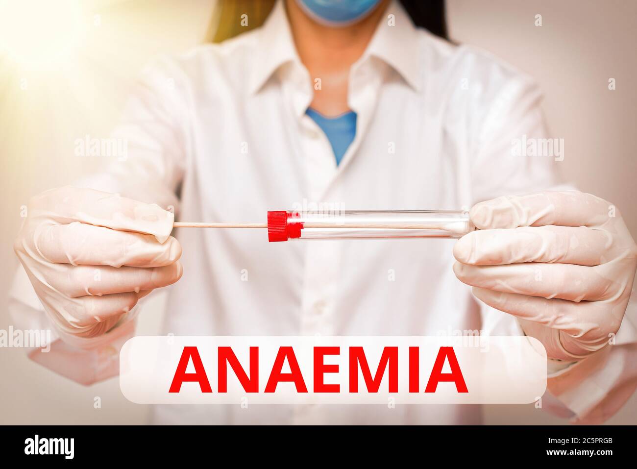 Word writing text Anaemia. Business photo showcasing a condition marked ...
