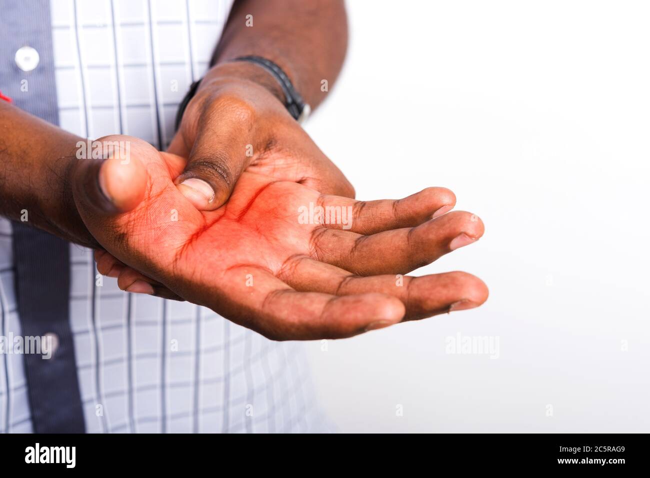 Closeup hand Asian black man holds his palm hand injury, feeling pain ...