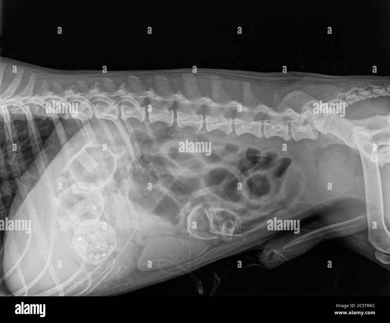 Digital X-ray of the abdominal cavity with four foreign bodies (corpus ...