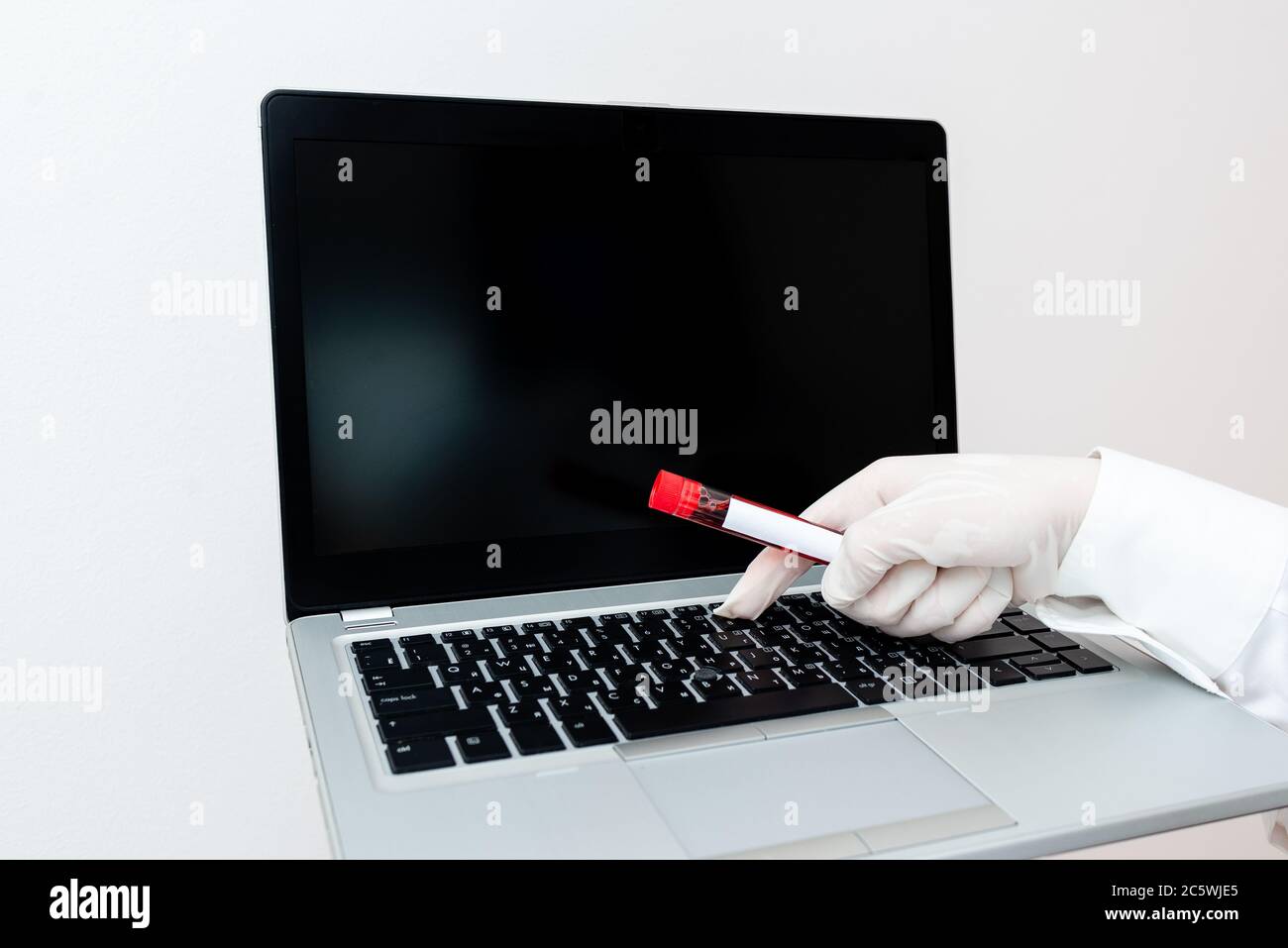 Extracted Blood Sample Vial With Lastest Technology Ready For ...