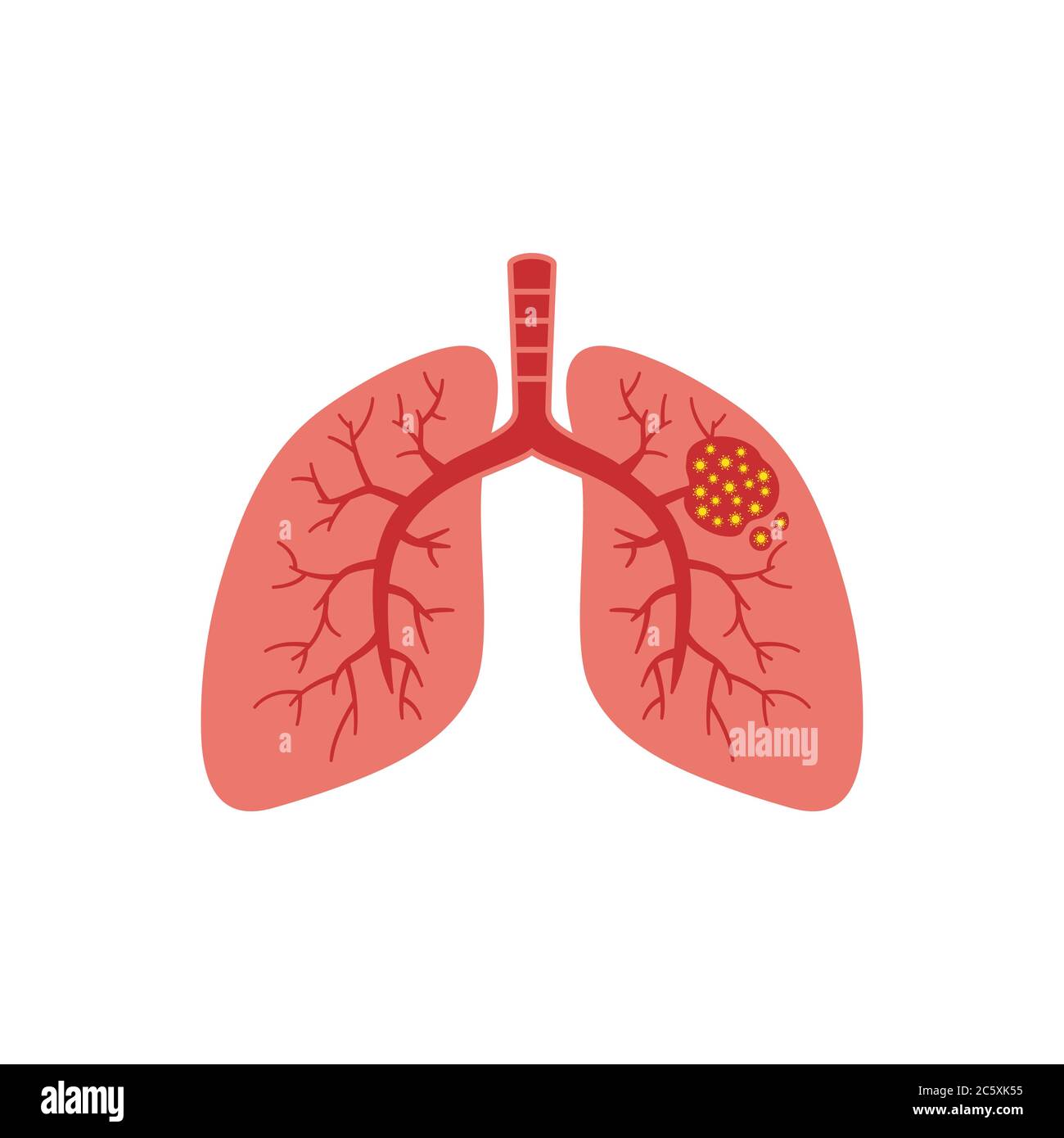red lung cancer design vector isolated on white background Stock Vector ...