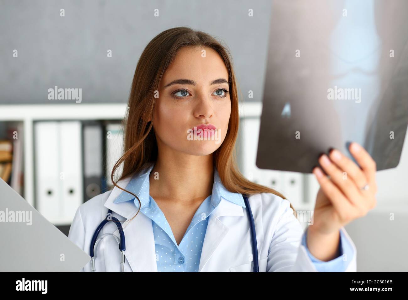 Beautiful female doctor hold in arm xray picture Stock Photo - Alamy