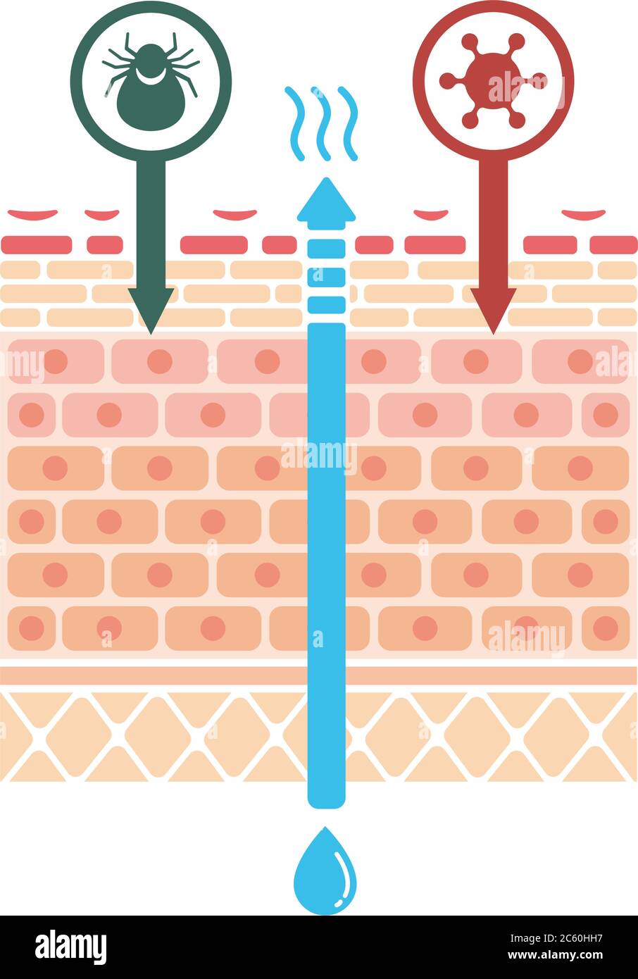 Sectional view of atopic dermatitis / vector illustration (no text ...