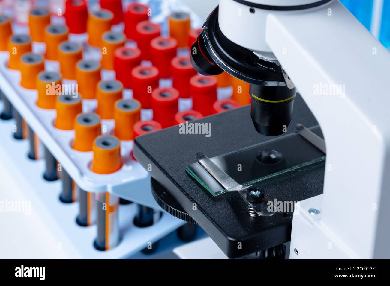 Microscope with blood samples test tubes close up Stock Photo - Alamy