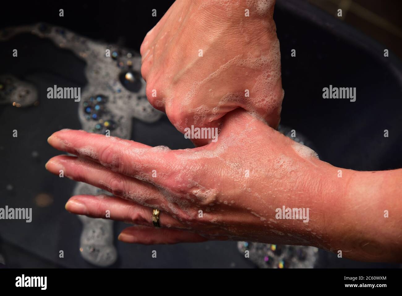 FRSM, Mask worn by a NHS employee, Also a series of pictures showing ...