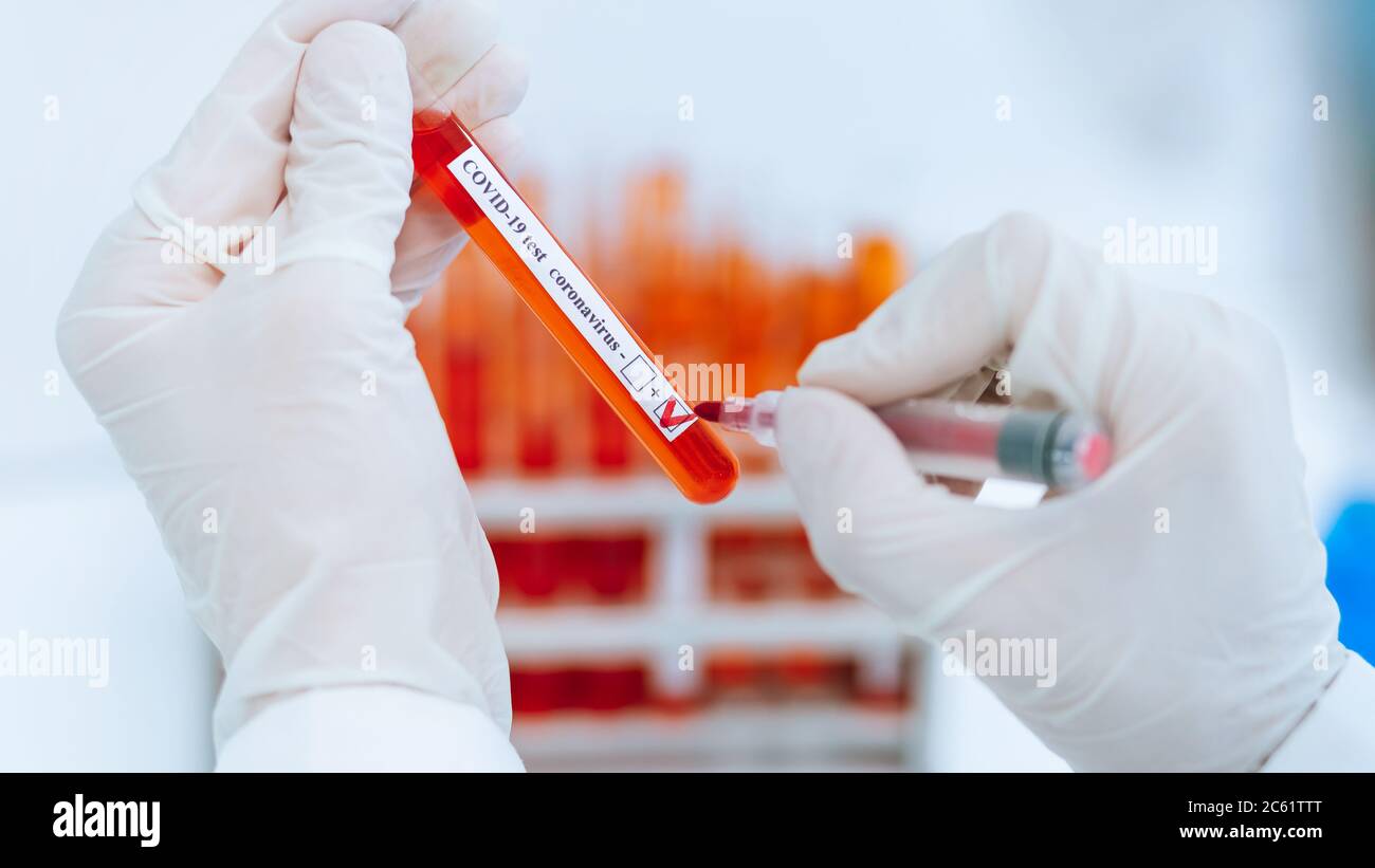 scientist puts a check mark on the tube with the test Stock Photo - Alamy