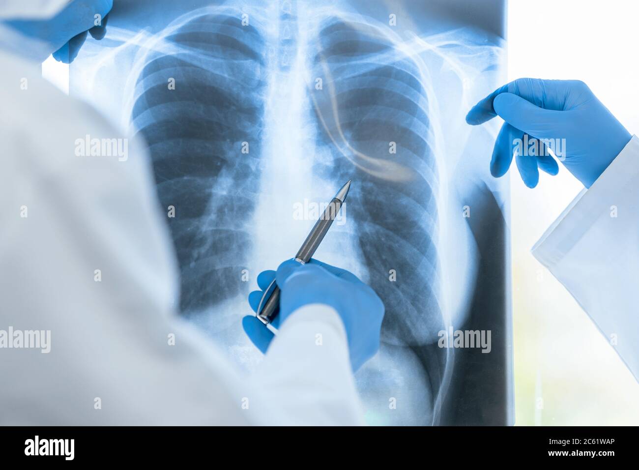 close up. doctors in protective clothing discussing an x-ray of the ...