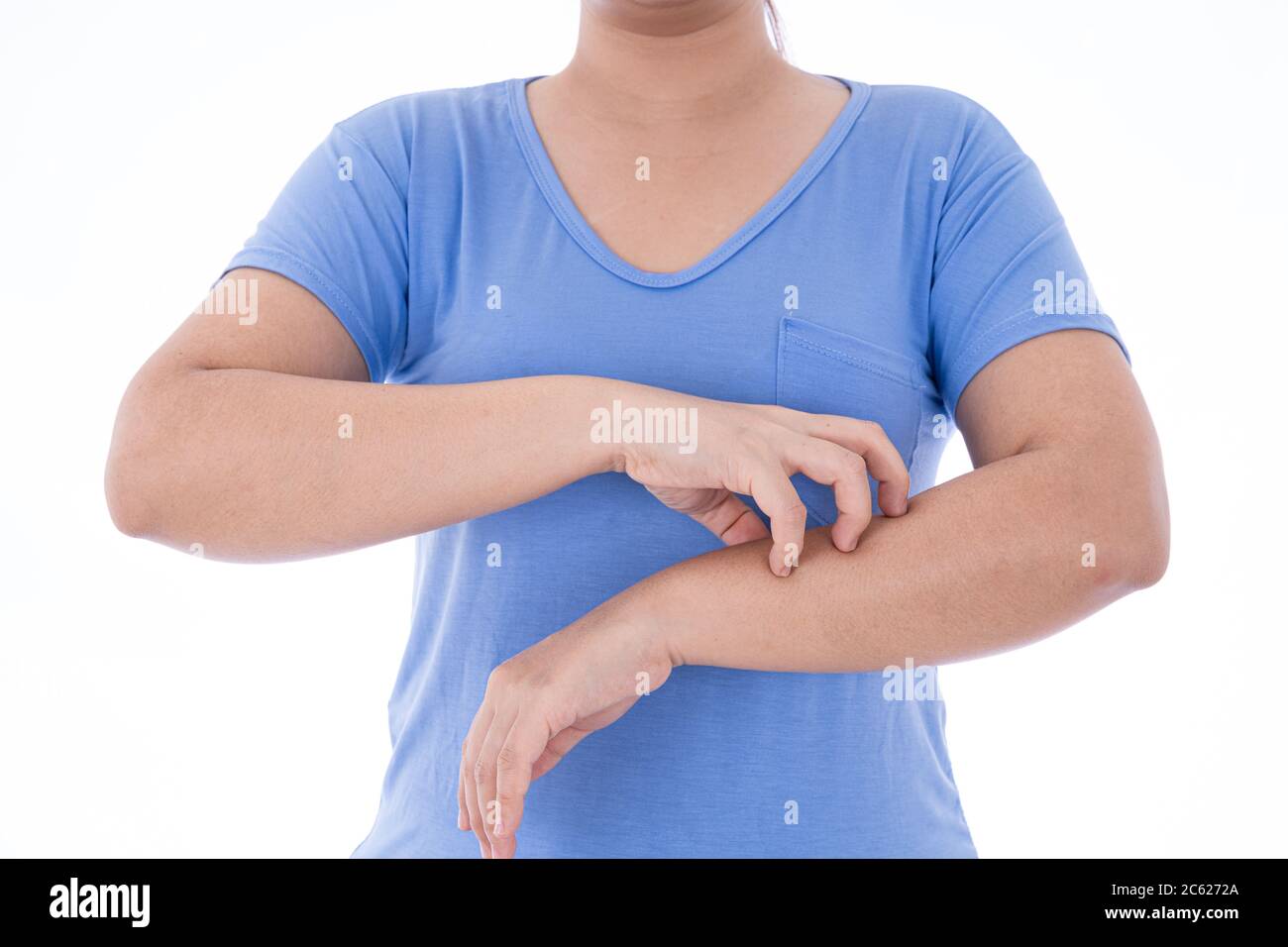 Female scratching her arm on isolated white background. Medical ...