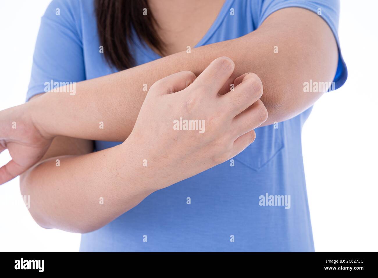 Female scratching her arm on isolated white background. Medical ...