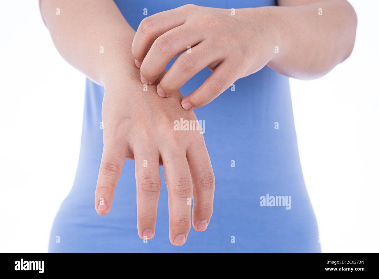 Female scratching her hand on isolated white background. Medical ...