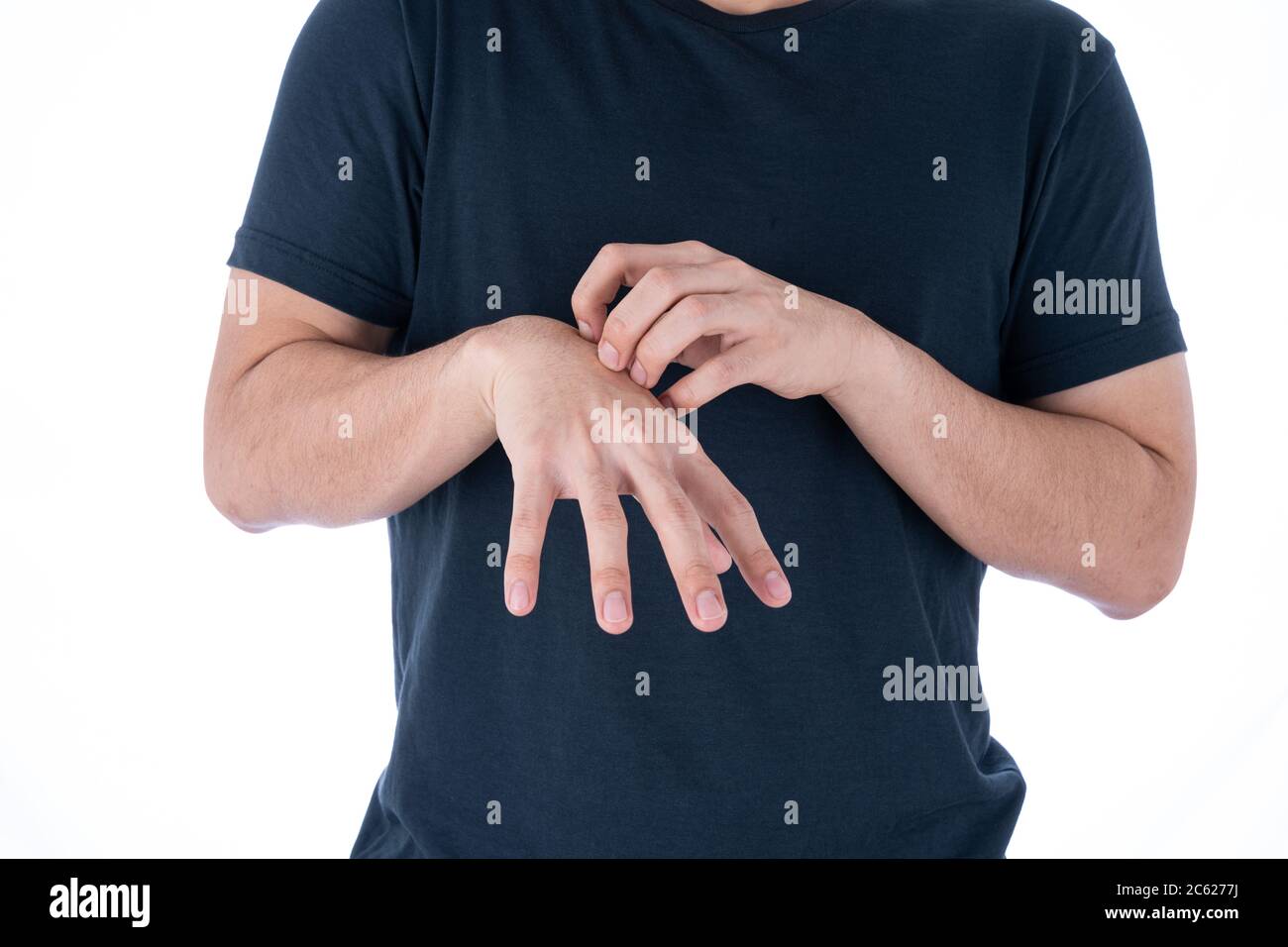 Male scratching his hand on isolated white background. Medical ...