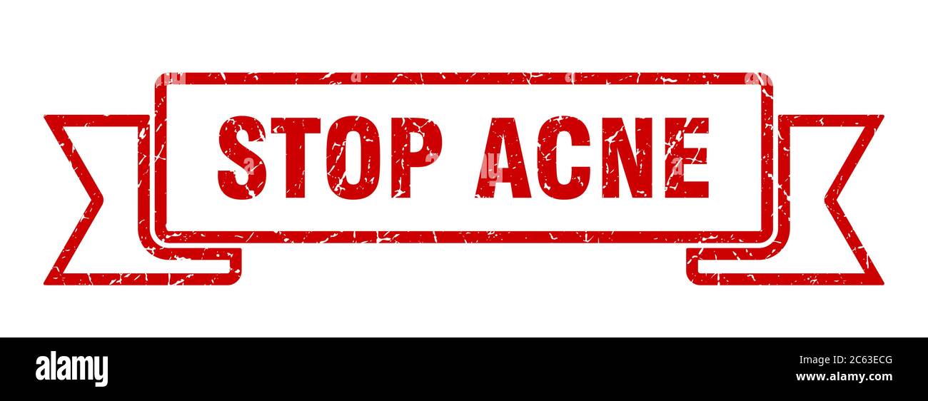 stop acne ribbon. stop acne grunge band sign. stop acne banner Stock ...