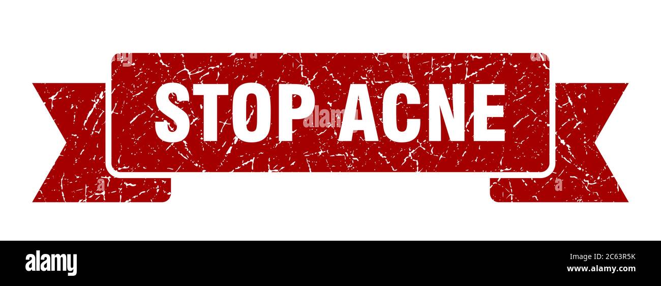 stop acne ribbon. stop acne grunge band sign. stop acne banner Stock ...