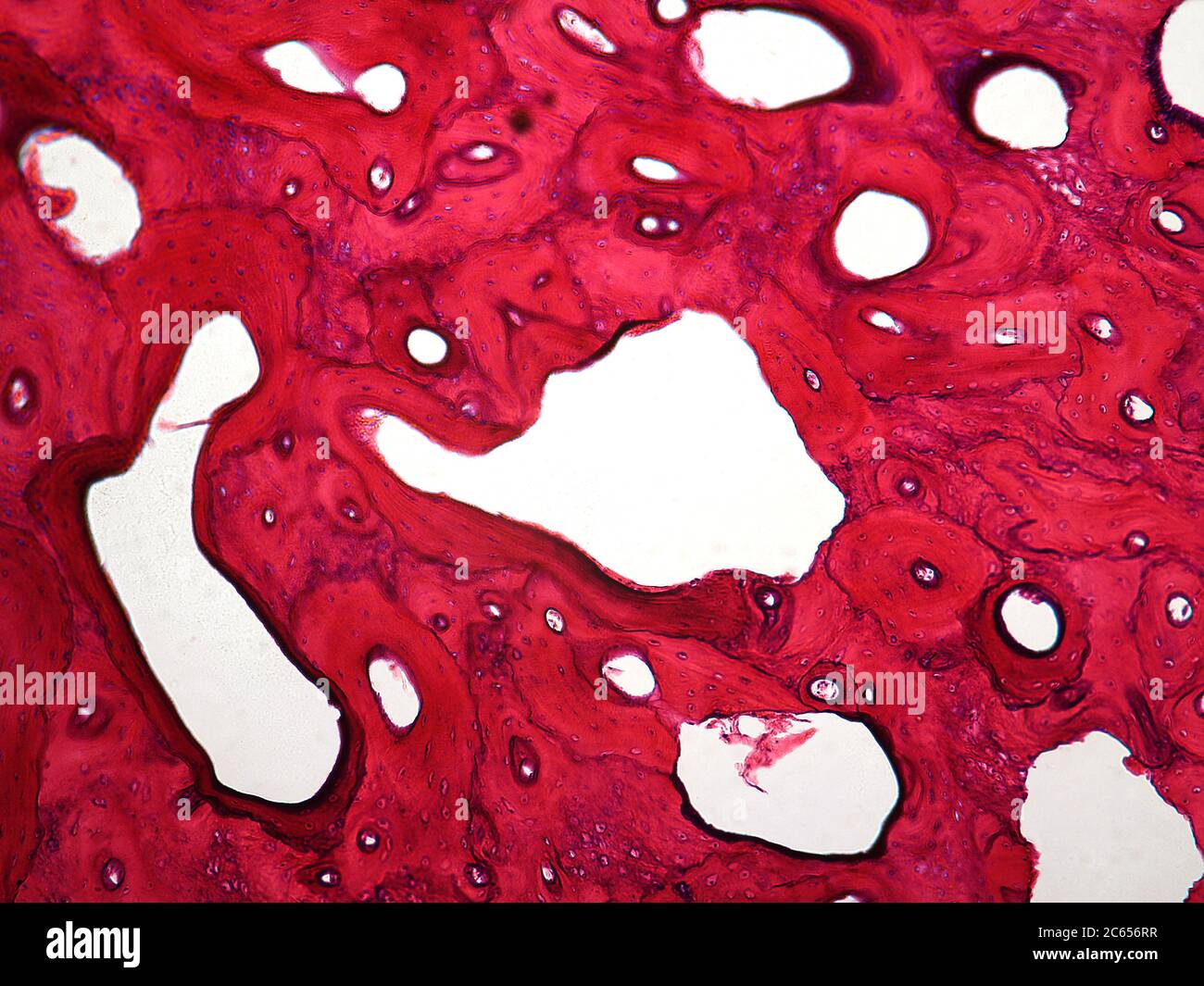 Bone Cells Microscope