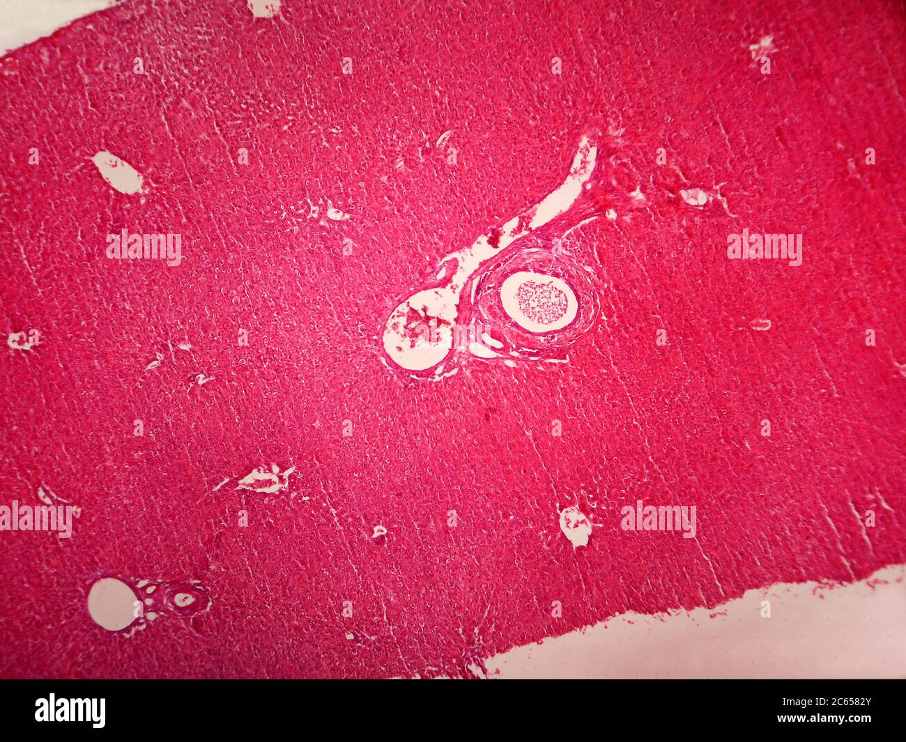 Parasites microscope hi-res stock photography and images - Alamy