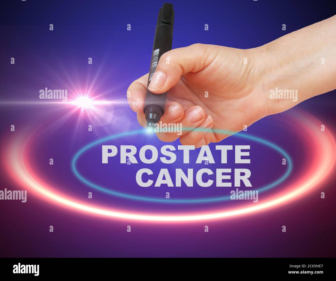 writing word PROSTATE CANCER with marker on gradient background made in ...