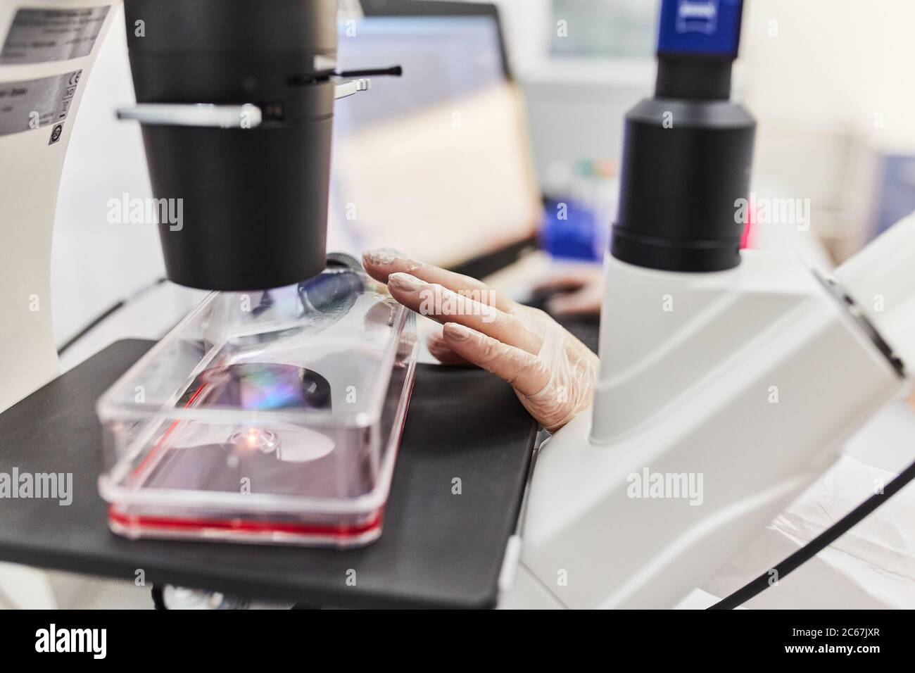 Platelets microscope hi-res stock photography and images - Alamy