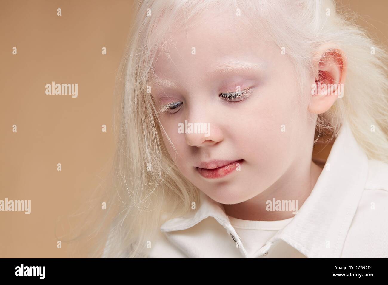 close-up portrait of little caucasian girl with albinism syndrome. kid ...