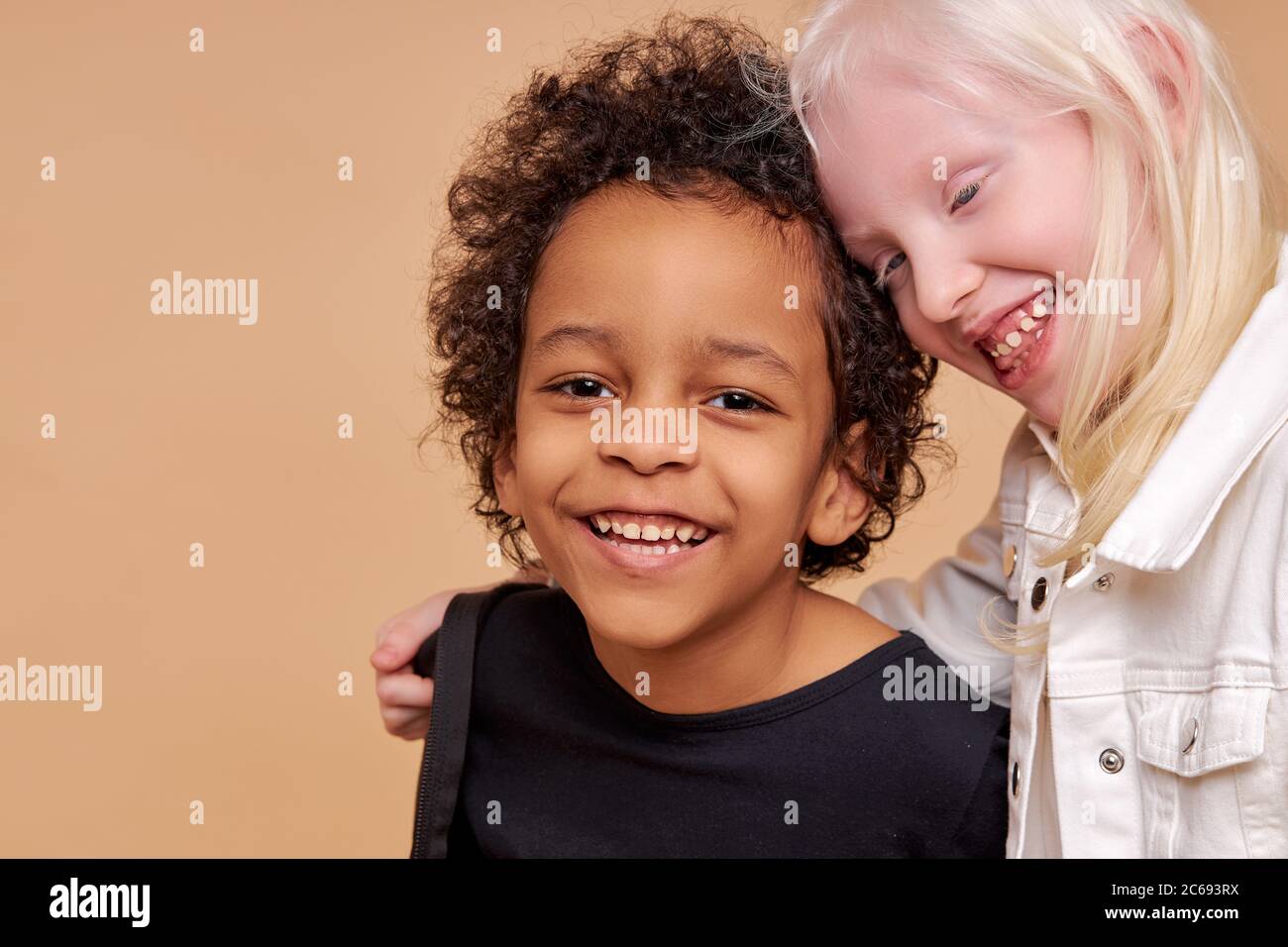 portrait of friendly children, tender african and albino kids standing ...