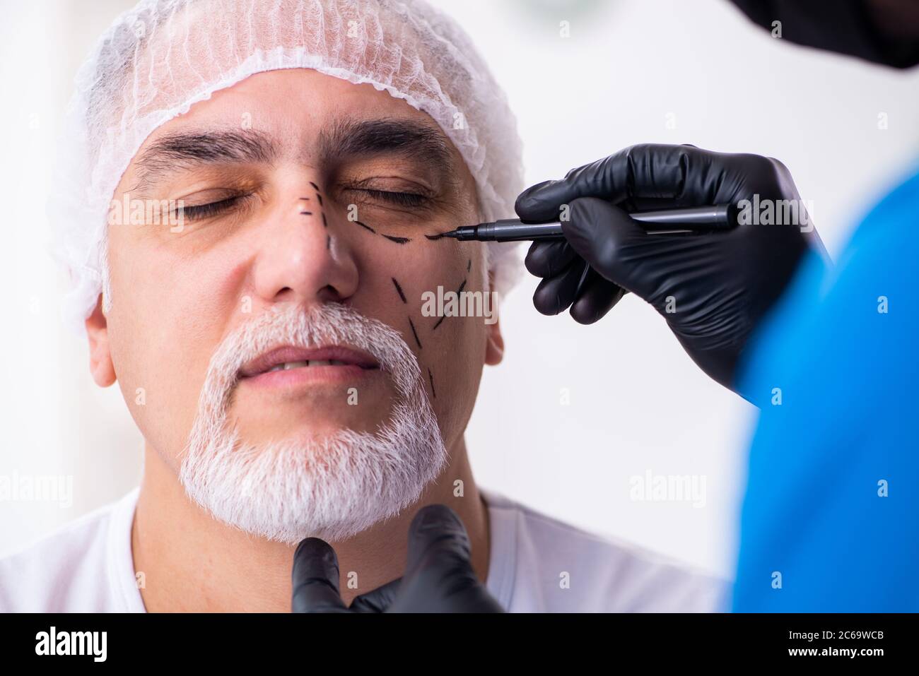 Old man visiting doctor for plastic surgery Stock Photo - Alamy
