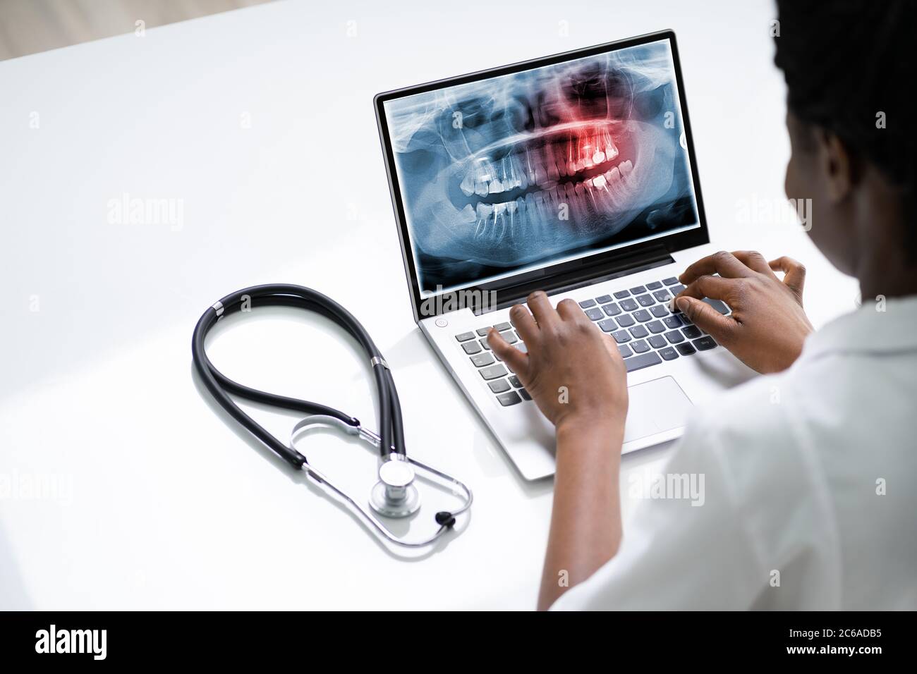 Xray teeth hi-res stock photography and images - Alamy