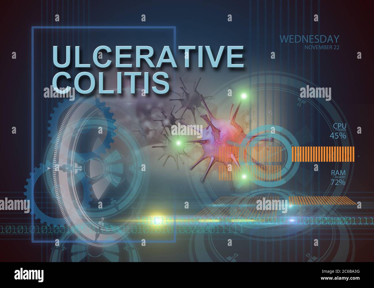 hi tech infographics of ulcerative colitis made in 3d software Stock ...