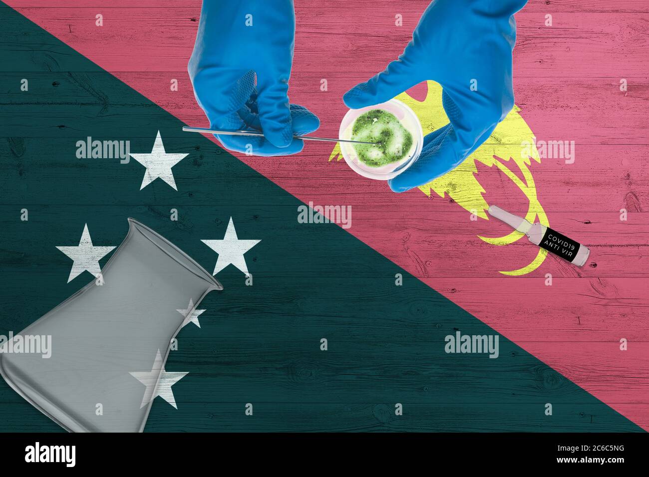 Papua New Guinea flag on laboratory table. Medical healthcare ...