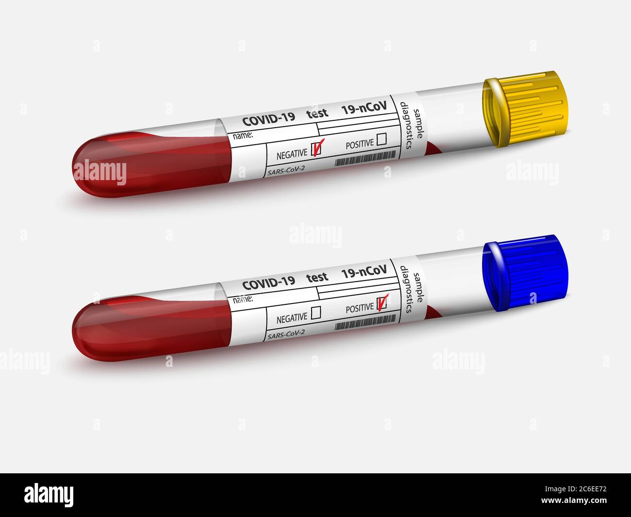 Blood sample in in two glass test tubes. Covid-19 test. Positive and ...