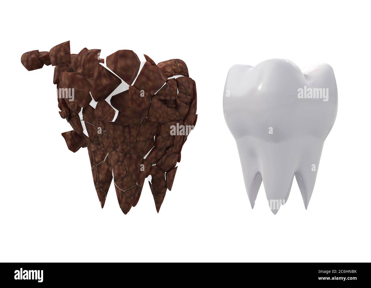 Tooth plaque cleansing concept. Dirty molar and clean tooth. 3d ...