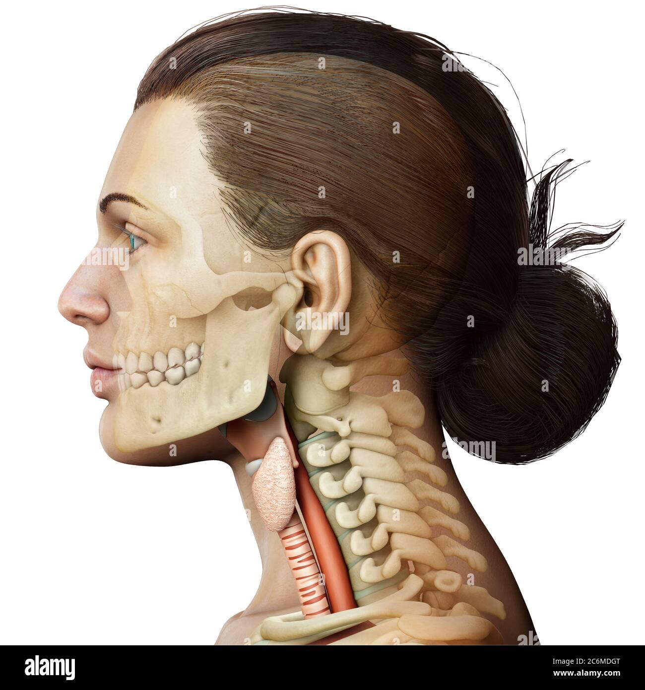 Laryngeal Prominence