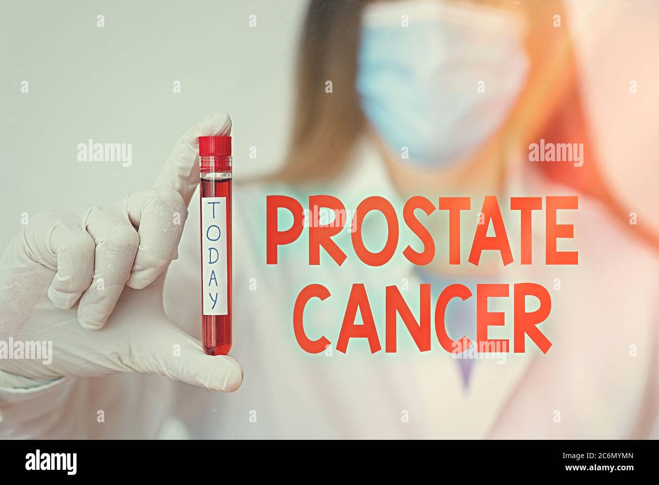 Handwriting text writing Prostate Cancer. Conceptual photo development ...