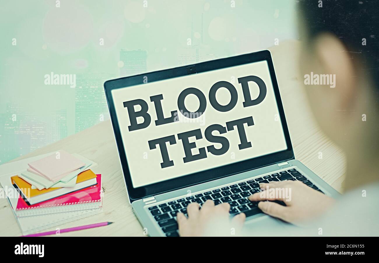 Writing note showing Blood Test. Business concept for Extracted blood ...