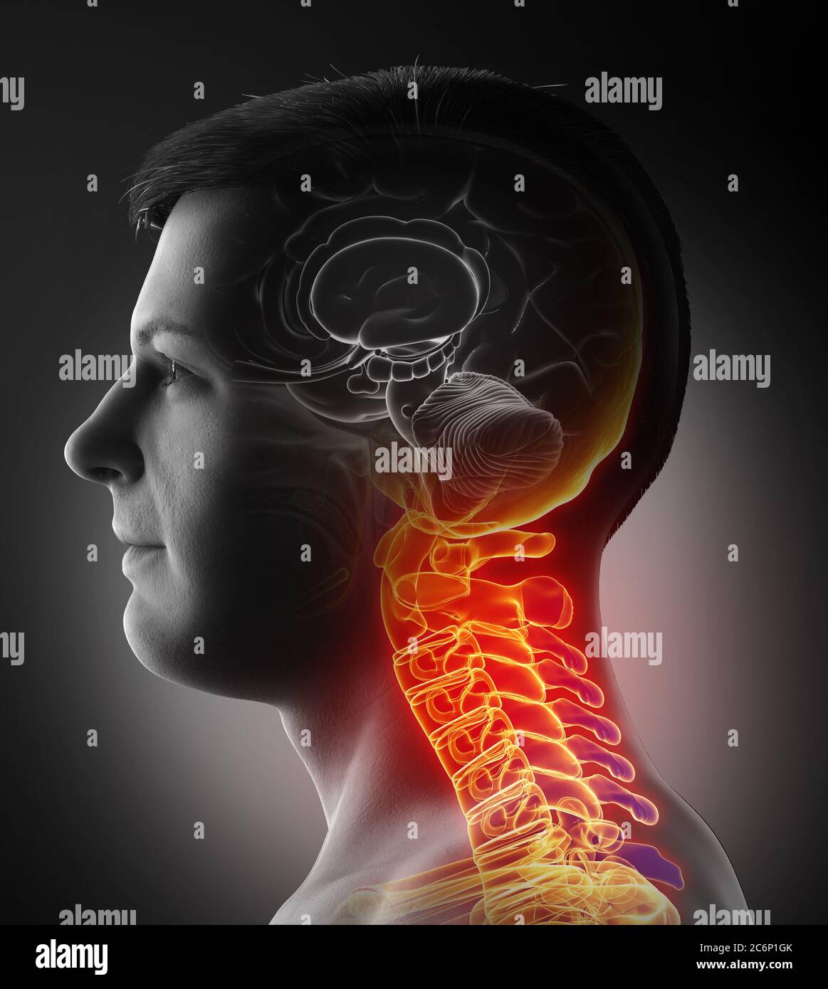 3d rendered, medically accurate illustration of male having a painful ...