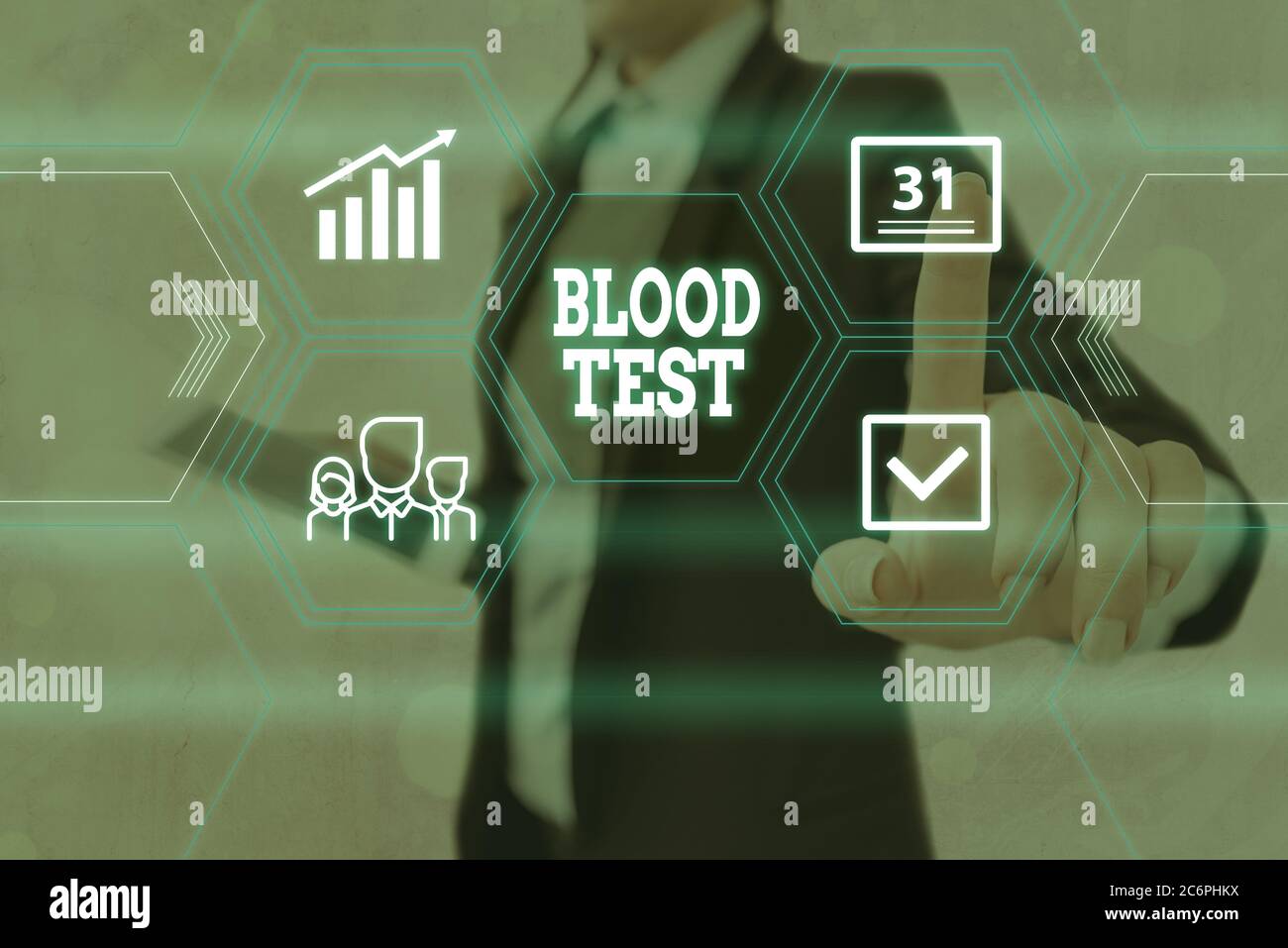 Text sign showing Blood Test. Business photo showcasing Extracted blood ...