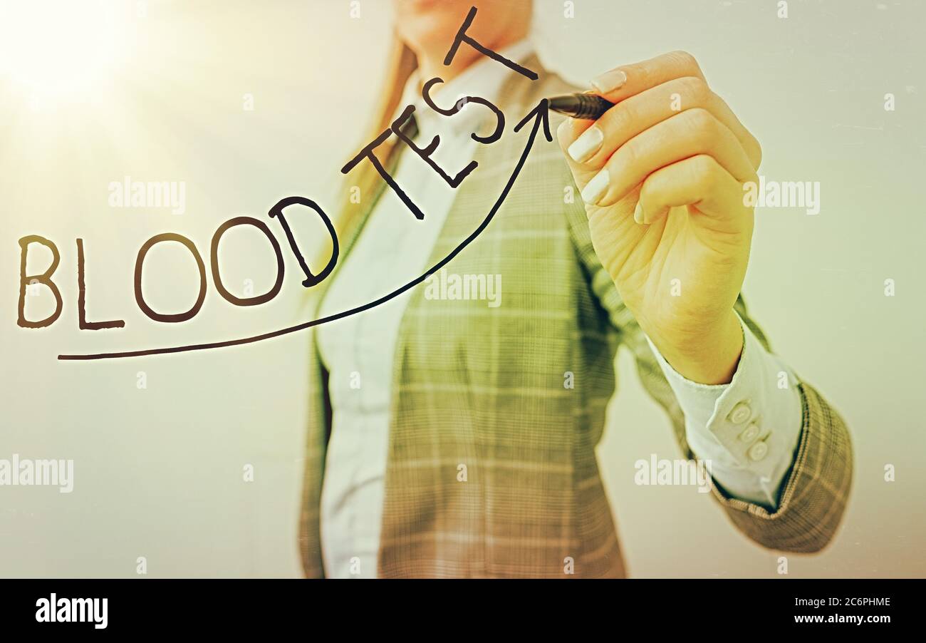 Writing note showing Blood Test. Business concept for Extracted blood ...