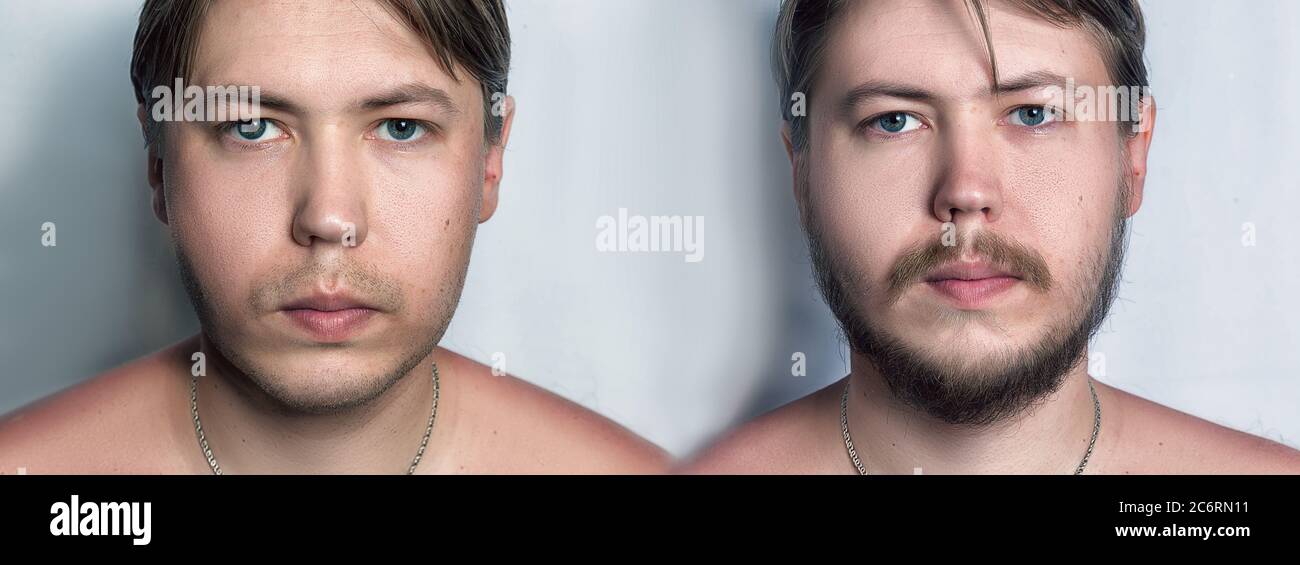 Before after resolution hi-res stock photography and images - Alamy