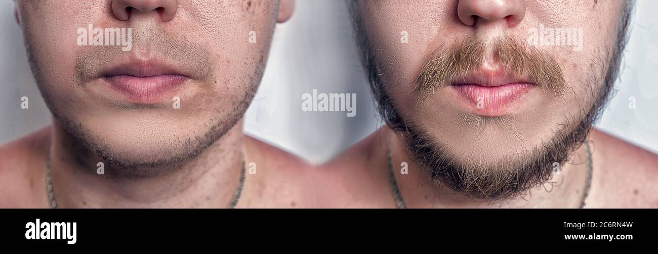 Young handsome Man Face Before And After Shaving Stock Photo - Alamy