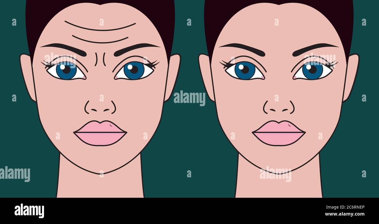 Smooth forehead Stock Vector Images - Alamy