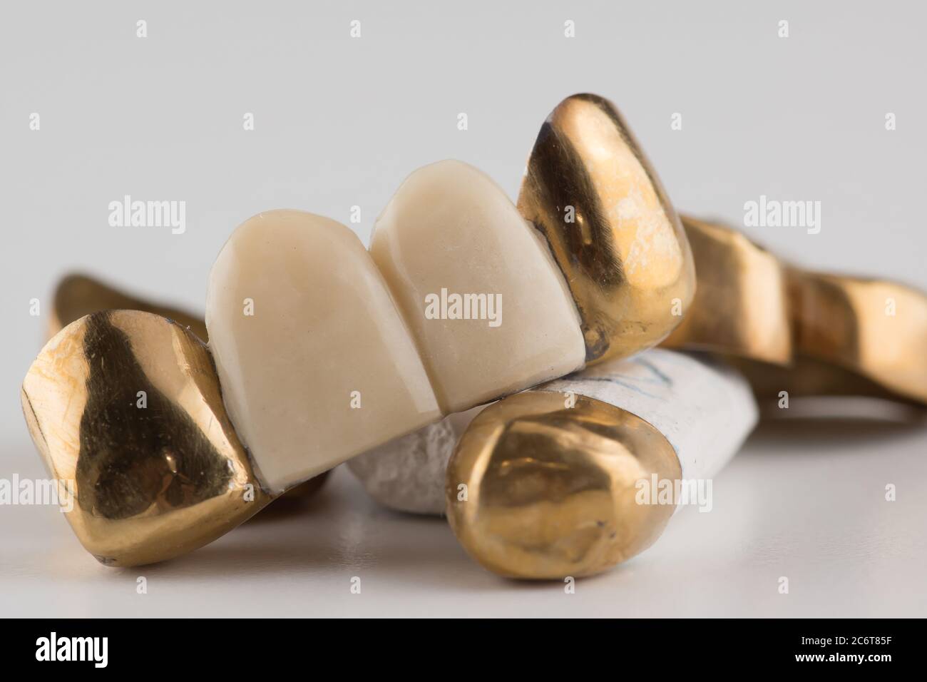 stamped brazed dental bridges covered with gold coated on white ...