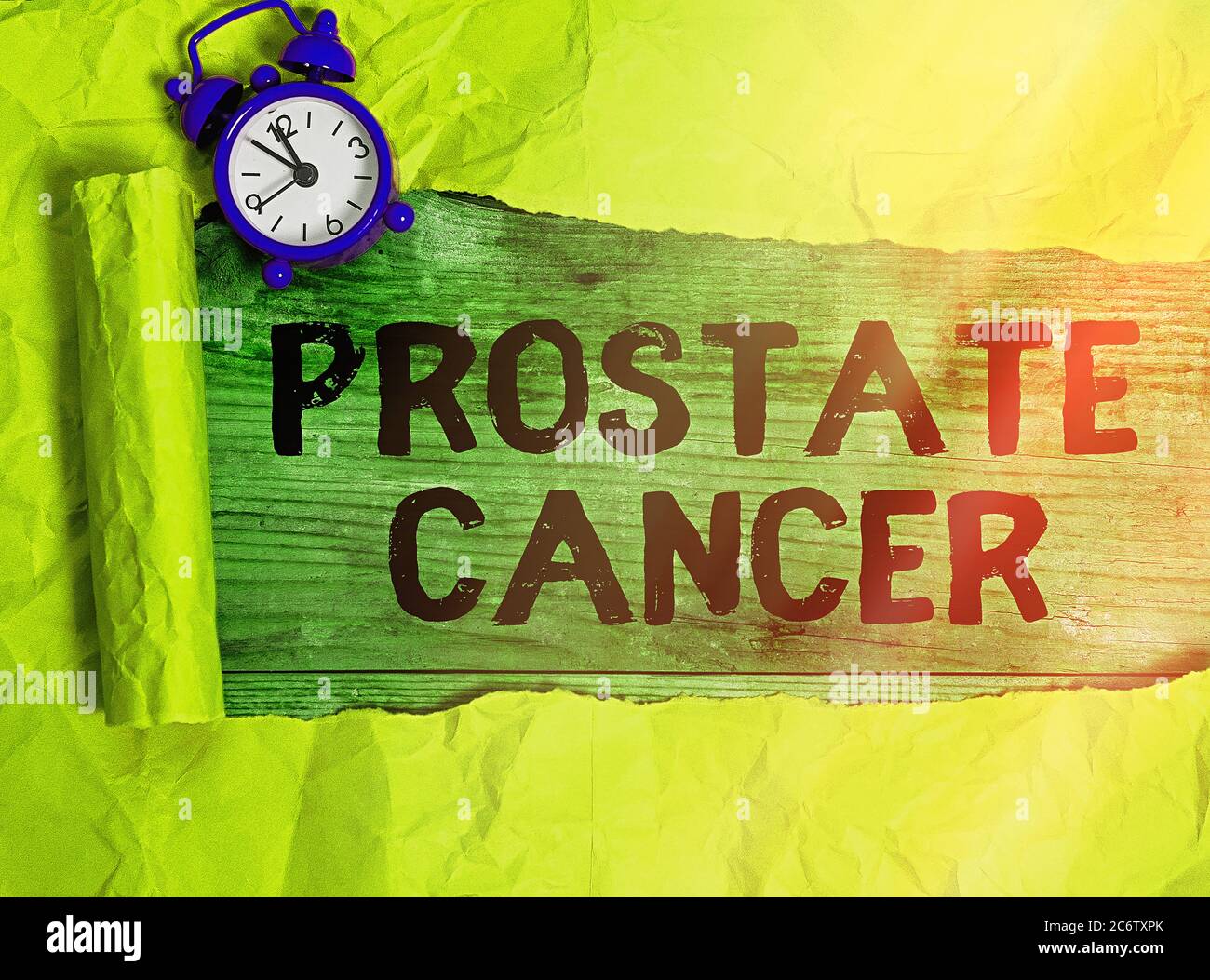 Word writing text Prostate Cancer. Business photo showcasing ...