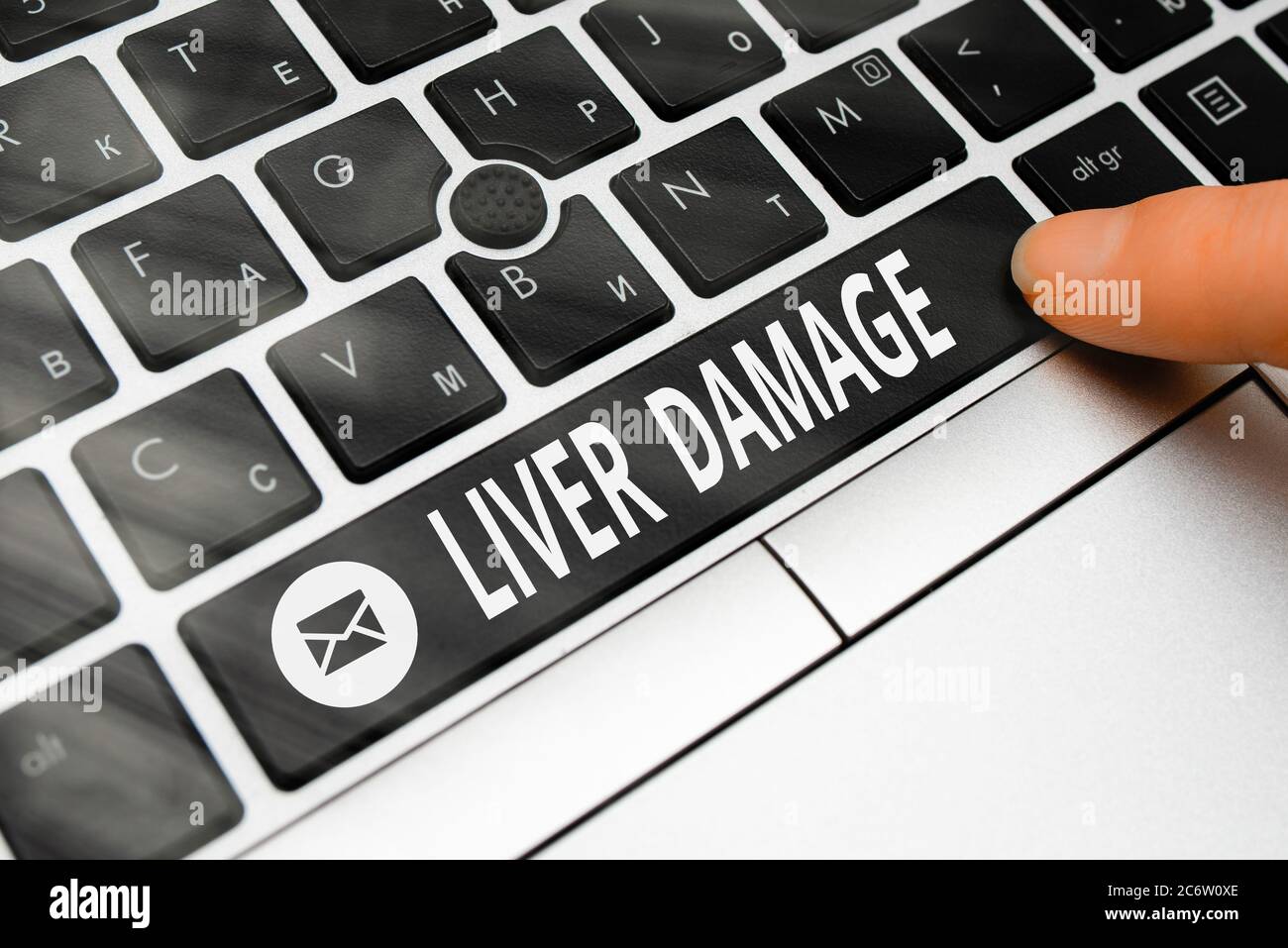 Conceptual hand writing showing Liver Damage. Concept meaning any ...